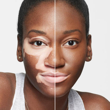 Cover Creme | Full Coverage Cream Foundation for Discoloration ...